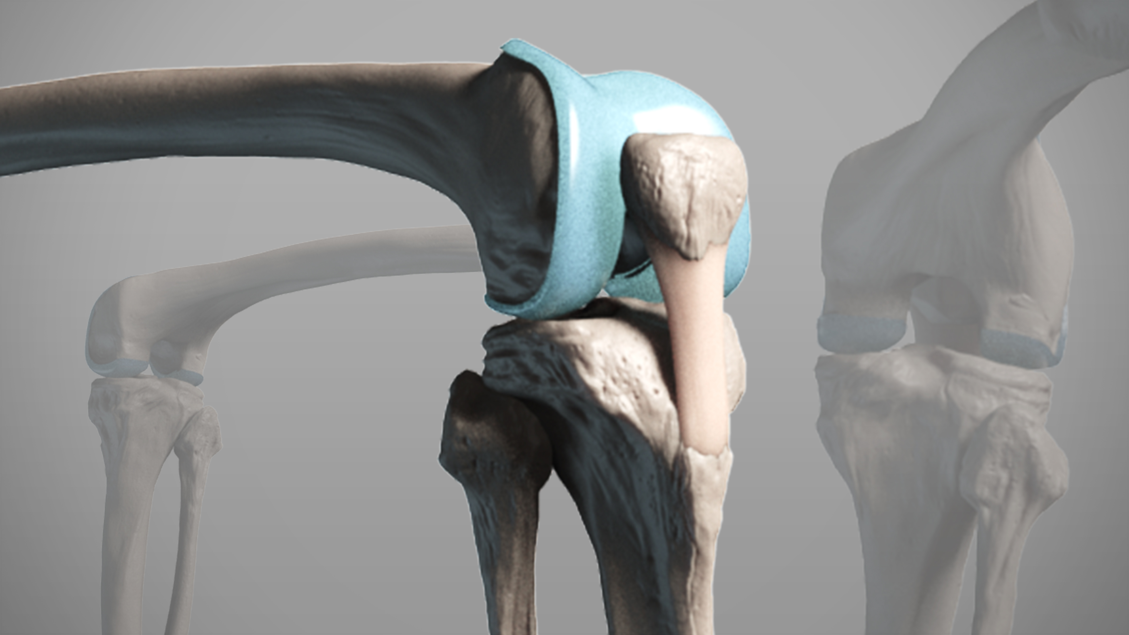 Proko - 3D Model: Bent Knee